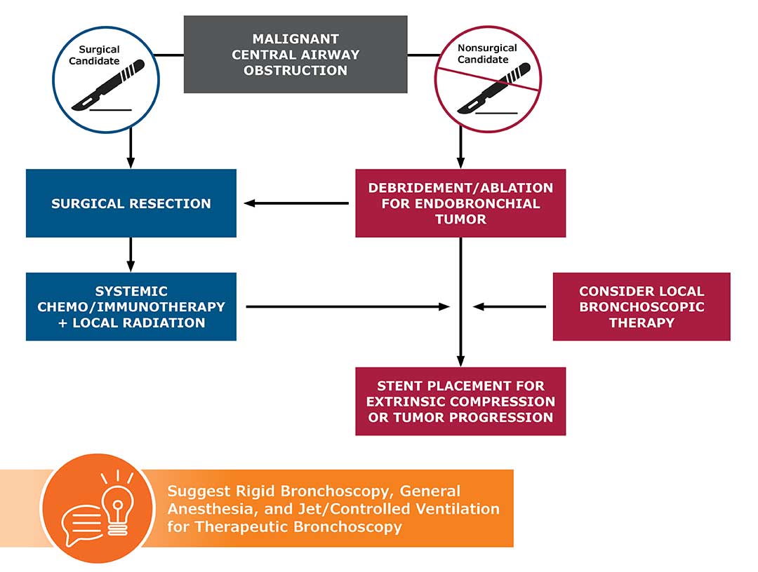 Suggested Approach for the Management of Malignant Central Airway ...
